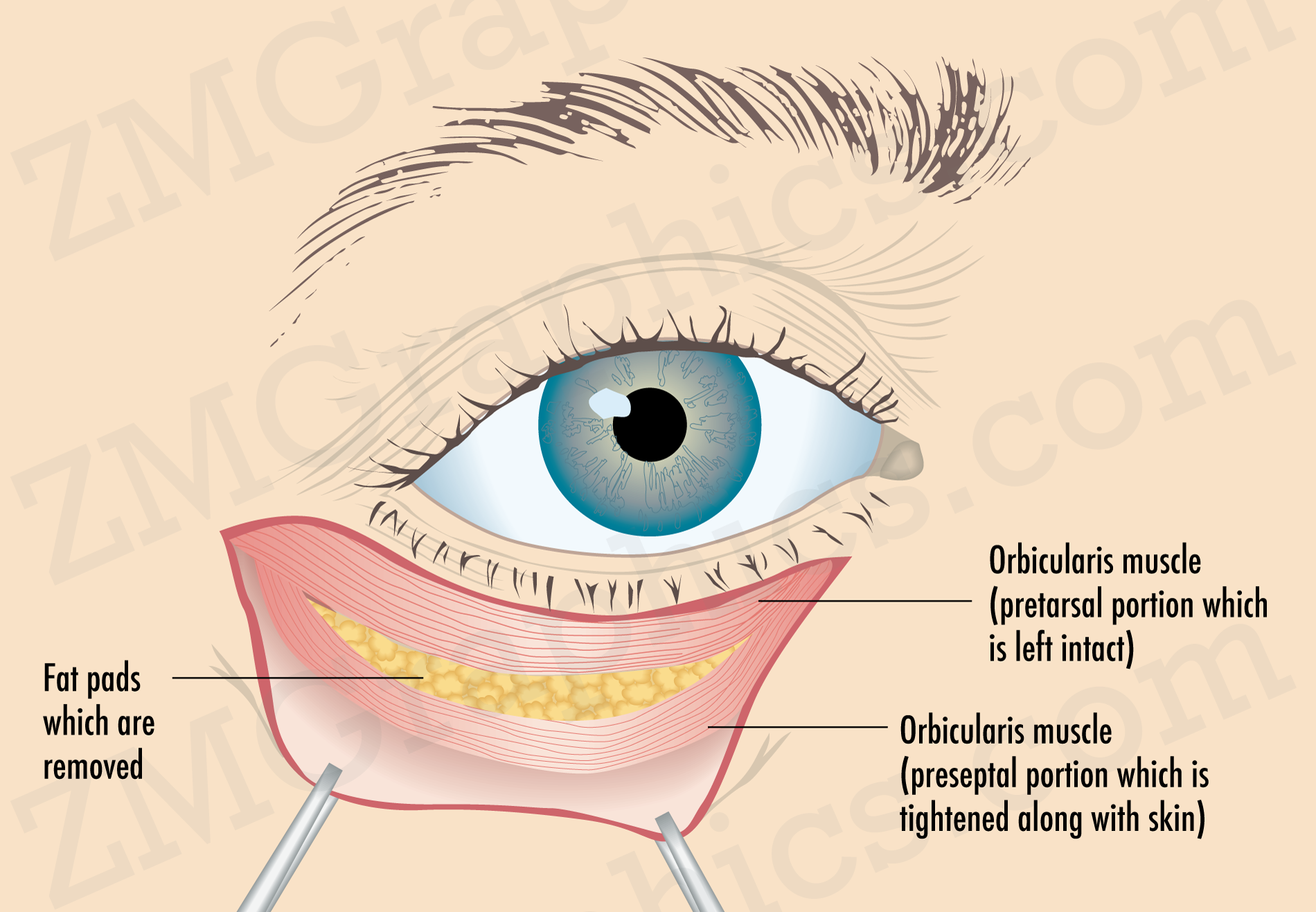 Medical portfolio by Carol Zuber-Mallison•ZM Graphics